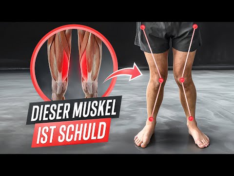 3 Übungen um X - Beine zu korrigieren (Teil 2)