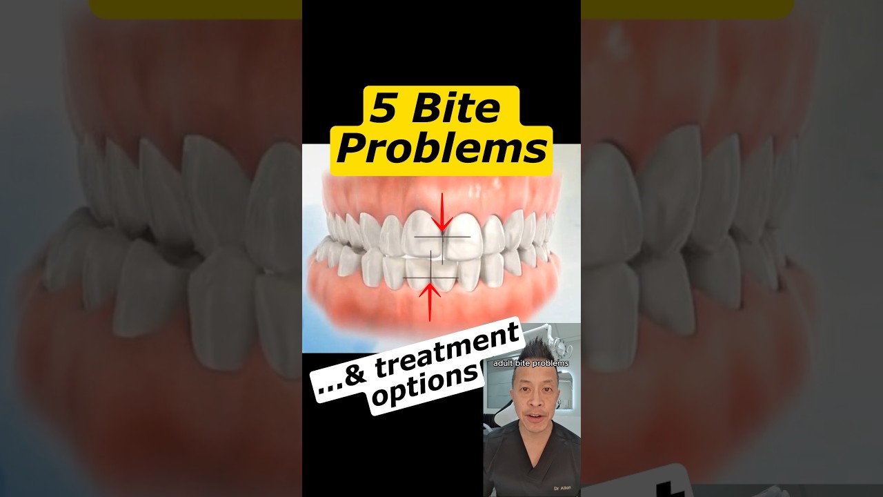 Adult Bite Problems: What They Are & How to Fix Them #dentallan #dentist #shorts