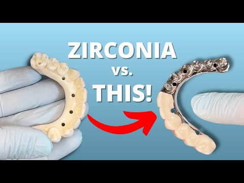 THE BEST Option | All On 4 Zirconia vs. Titanium Frame With Individual Crowns