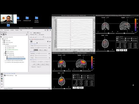 EEG source imaging of epilepsy recordings using Brainstorm