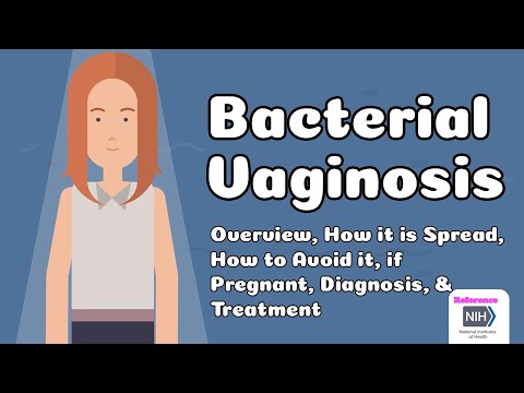 Bacterial Vaginosis - Overview, How it is Spread, How to Avoid it, if Pregnant, Diagnosis, Treatment