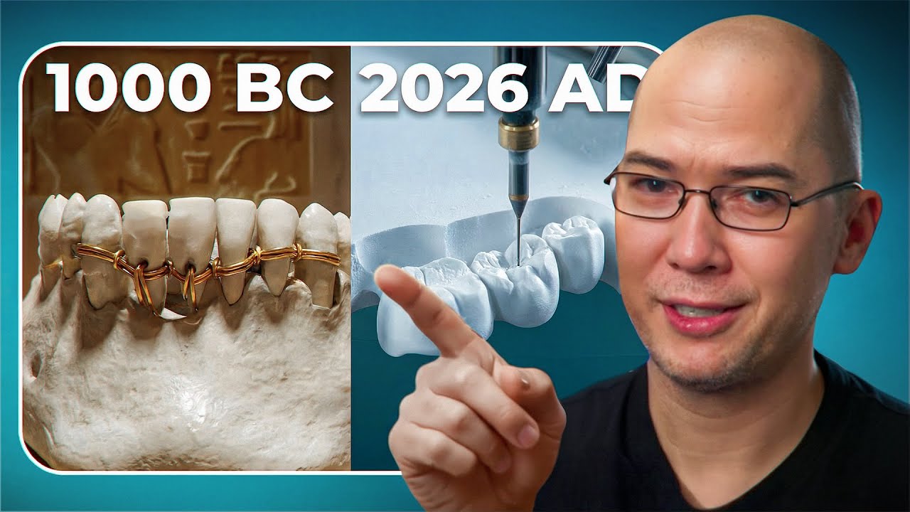 Dental Implants Explained - The Full History