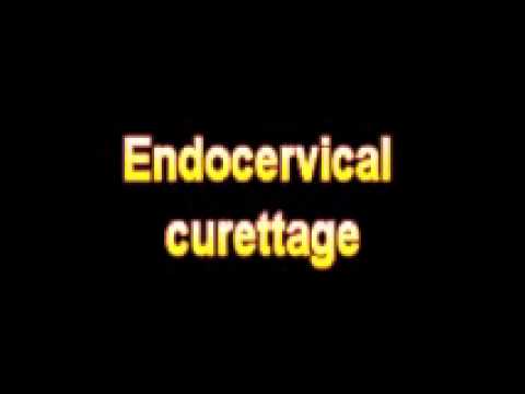What Is The Definition Of Endocervical curettage - Medical Dictionary Free Online