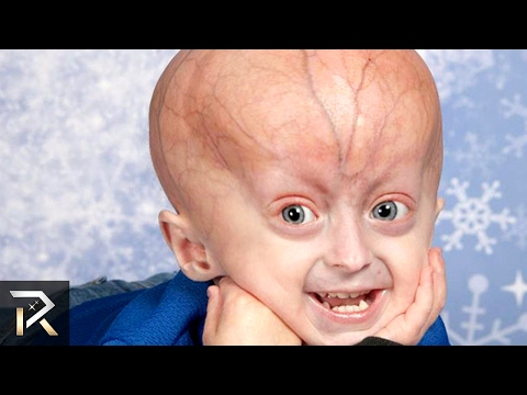 10 Bizarre Human Conditions Finally Explained