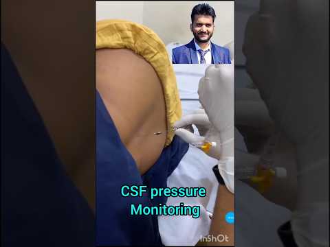 CSF pressure monitoring #cerebro spinal fluid pressure #shorts #Meningitis