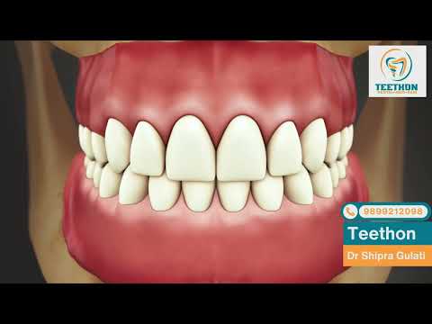 Anatomy and function of Canine tooth