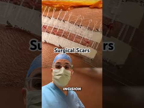Zip Tie Your Surgical Incision #shorts