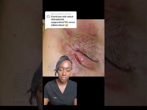 Painful Boils Under Armpits!...Could it be Hidradenitis Suppurativa?