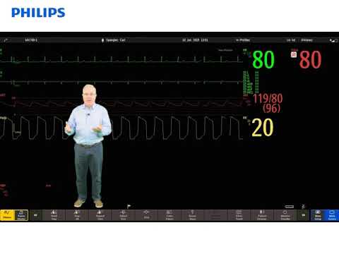 Cardiac & Multi Parameter Patient Monitor - Multipara Monitor Latest ...