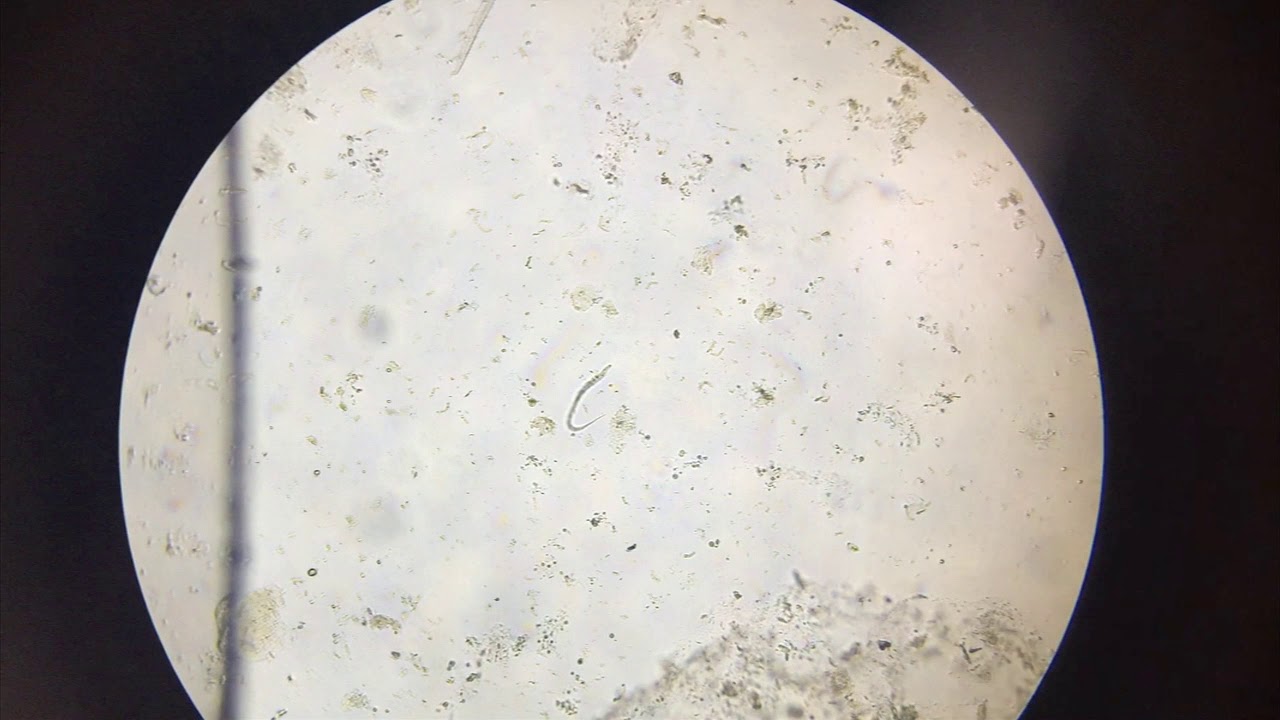 Live Nematode Worm under the microscope 100x