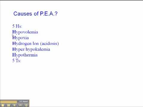 ECG: Pulseless Electrical Activity (PEA)