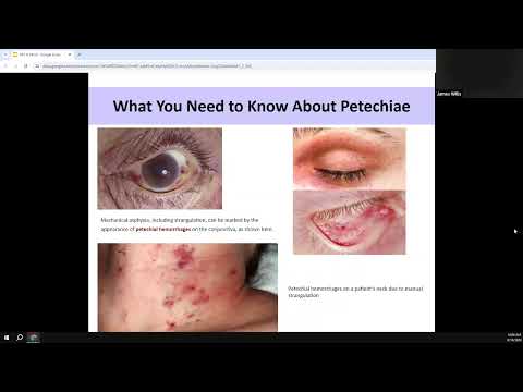 Dr. Datta and Dr. Agenor - Forensics - Non Fatal Strangulation