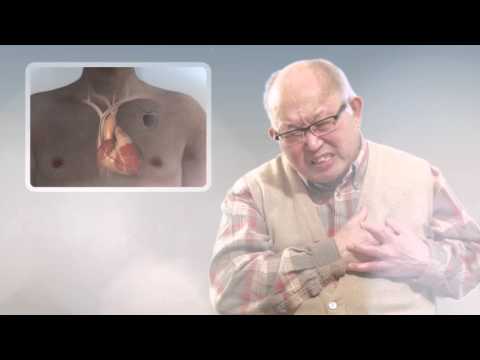 What is an ICD?