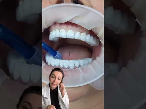 What Dental Crowns Are Use For ?