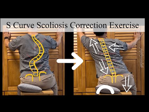 Scoliosis : Double Curve Scoliosis Correction Exercise in Sitting (S Curved Spine)