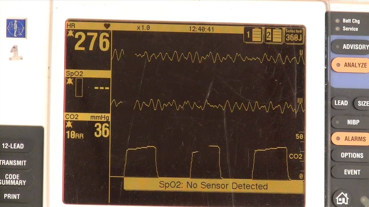 Waveform capnography demonstration