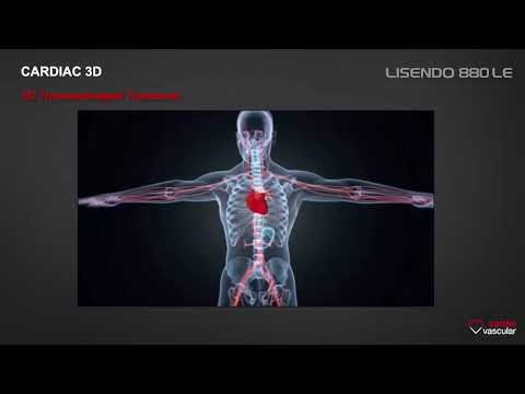 REVISED AUDIO: Introducing Fujifilm Lisendo 880 LE