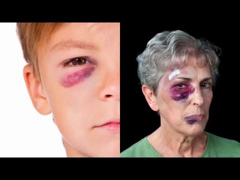 Abuse and Neglect Investigations