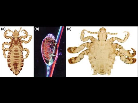 Différences entre Pediculus Humanus et Phthirus Pubis
