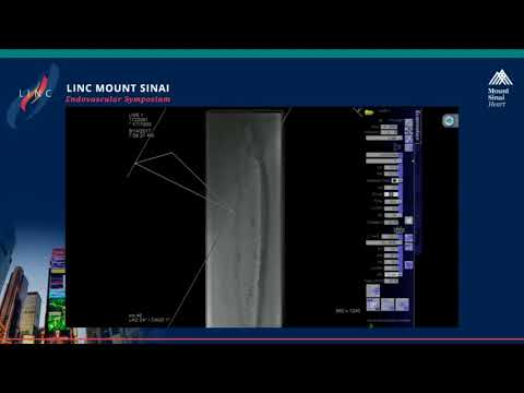 Live Case Presentation #9