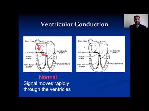 PVC Premature Ventricular beat Interpolated English Dr.Fawad Farooq