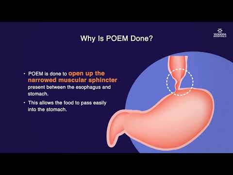 Peroral Endoscopic Myotomy (POEM) | Treatment For Achalasia of Esophagus and Esophageal Spasm
