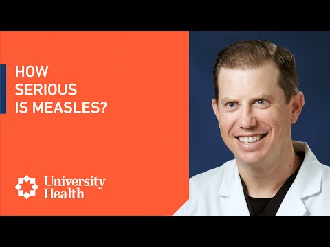 How Serious is Measles?