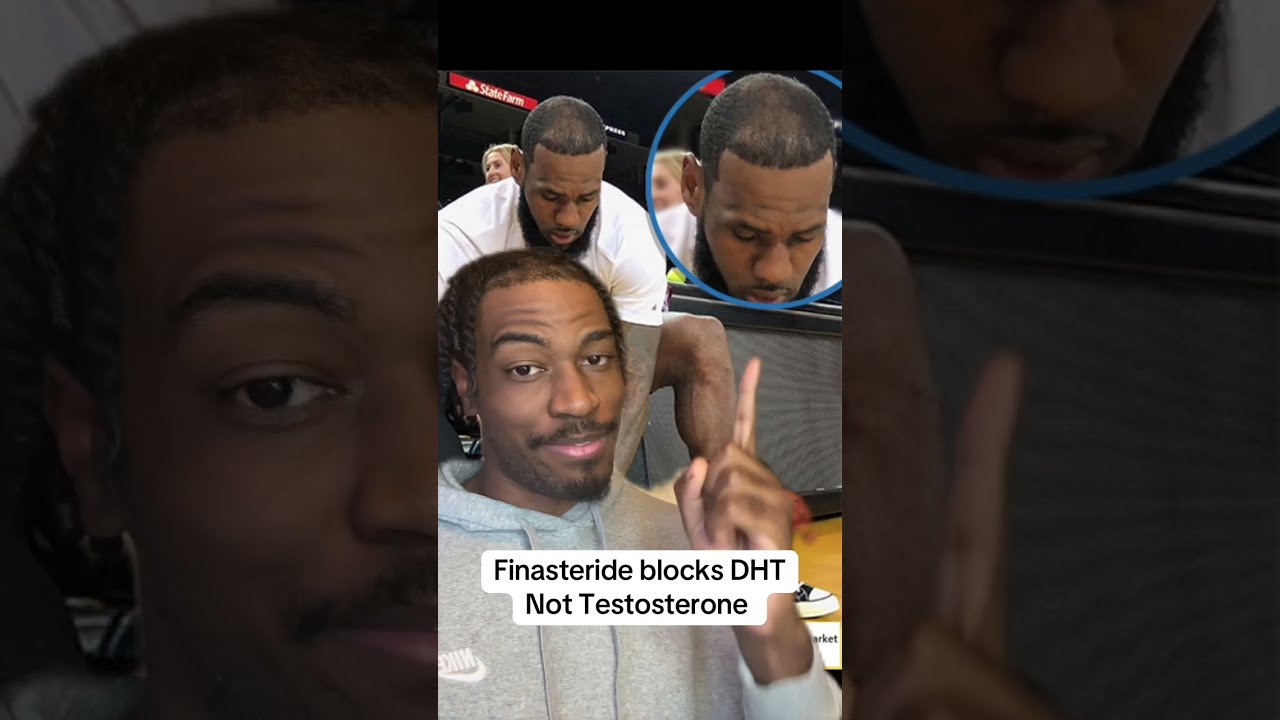 Not Even LeBron Could Escape Balding
