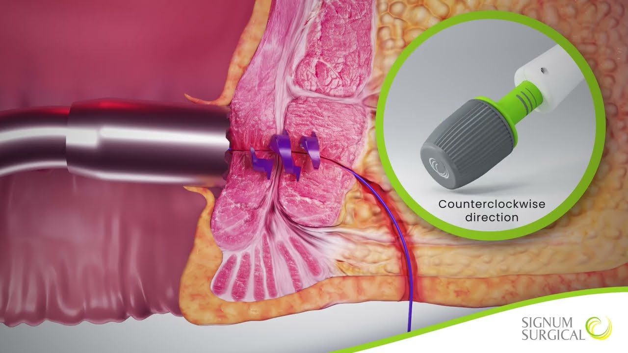 How BioHealx® Works