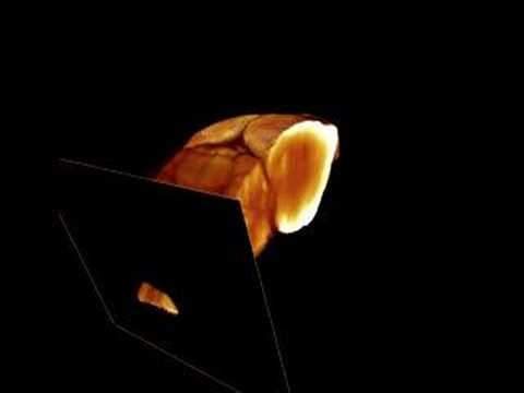 How to make a brain transparent