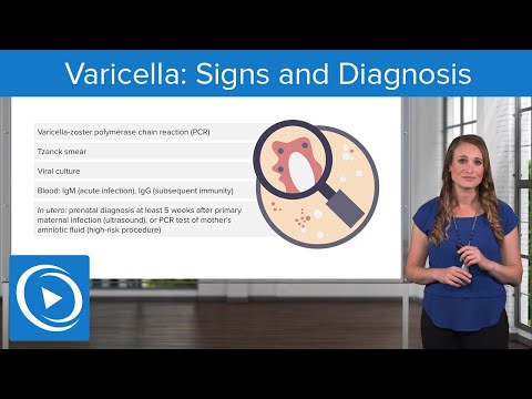 Varicella: Signs and Diagnosis – Pediatric Nursing | Lecturio Nursing