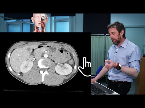 Abdomen transverse CT imaging anatomy