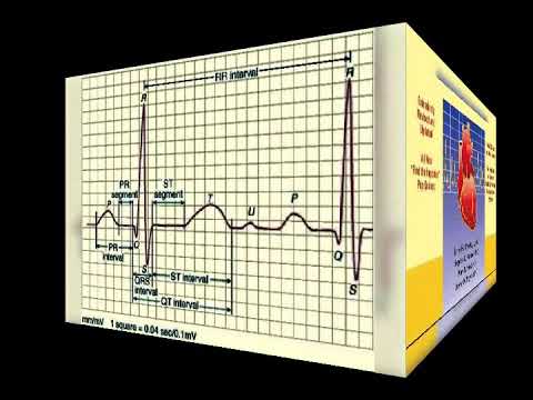 Detail of ECG by Dr.nadeem