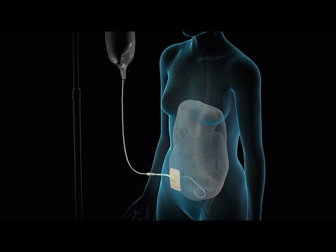 Dialysis | Nucleus Health