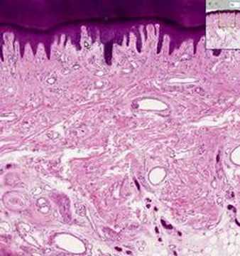 Shotgun histology videos | medikakurs