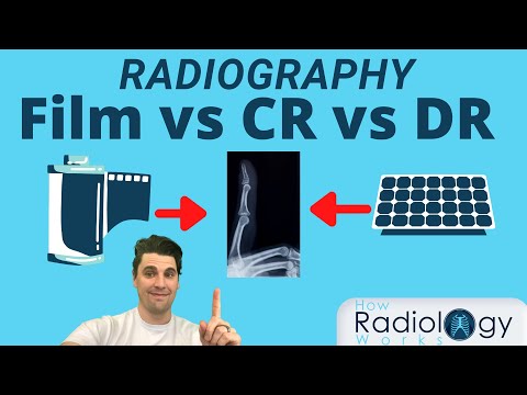 😻 What is the difference between VD and DV radiographs? - CatVisitor.com