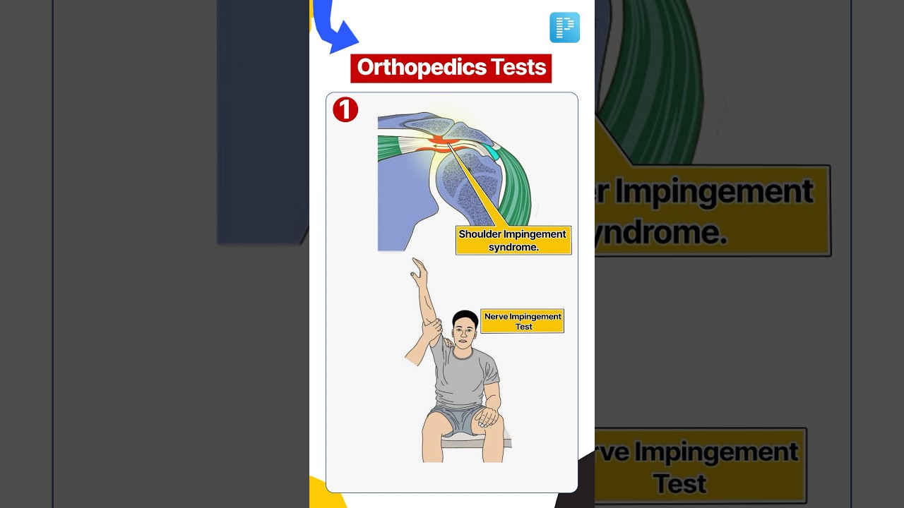 Orthopedics Test You Must Know!