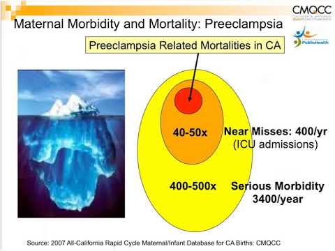 Preeclampsia Informational Webinar