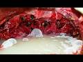 This GoPro Footage of a Rotting Watermelon Looks Like a Body Horror ...