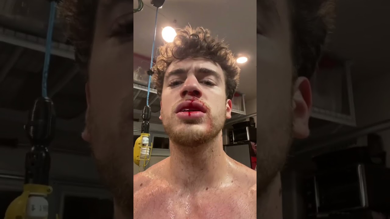 Part 2: why am I bl33ding? #health #capcut #icebath #blood #coldplunge