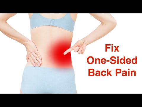 Fix One-Sided Back Pain (With FREE Exercise Sheet!)