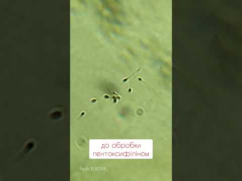 Restoration of sperm motility by pentoxifylline. Відновлення рухливості сперматозоїдів. #sperm #art