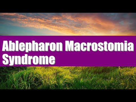 Ablepharon Macrostomia Syndrome Signs Symptoms Causes