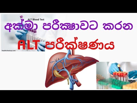 ALT Test එක ගැන | අක්මා රෝග ලක්ෂණ | Liver Function tests(Clear Explanation) | Sinhala|Mr MLT | 2021.