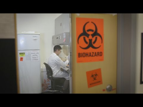 Chicago researchers help identify potential cure for lupus