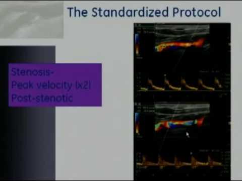 Carotid Doppler Protocol and Top Tips