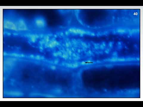 Fundamentals of Plant Diseases - Slide 40 - PHYTOPLASMAS: SIGNS: PHYTOPLASMA CELLS