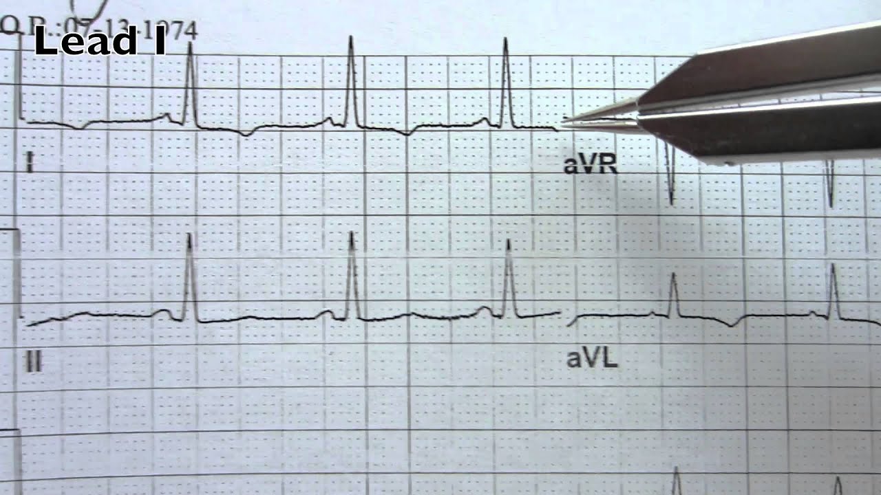 The Narula Series 3/8 The Best EKG Video Ever Part  Rhythm