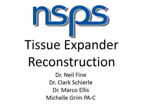 Tissue Expander Reconstruction