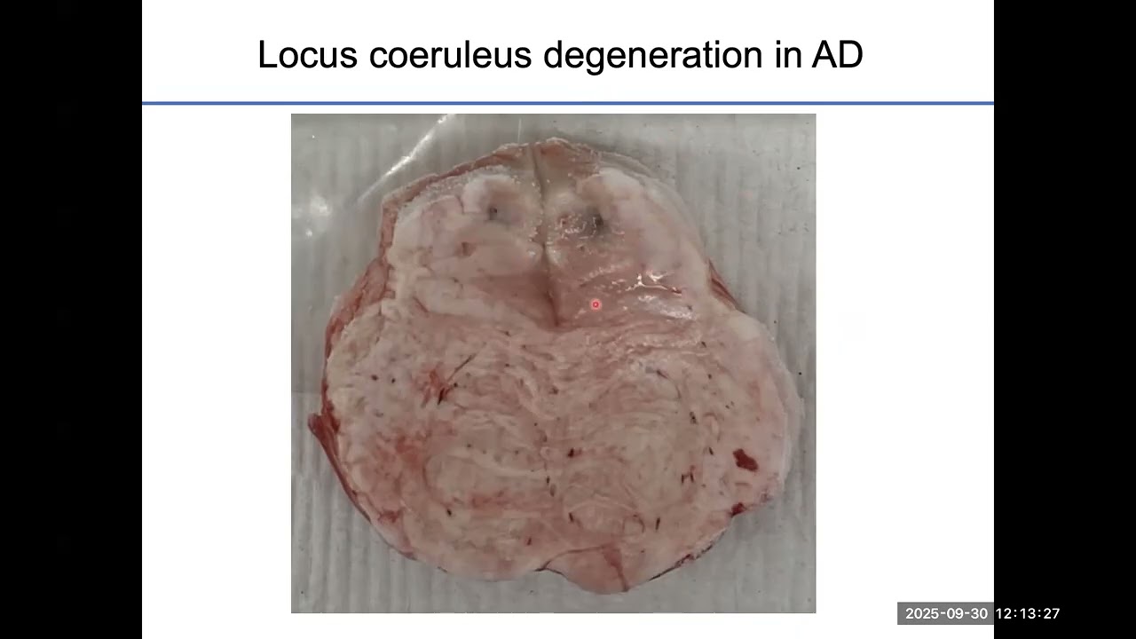 Dr. David Weinshenker | Mechanisms and Consequences of Locus Coeruleus Pathology in AD